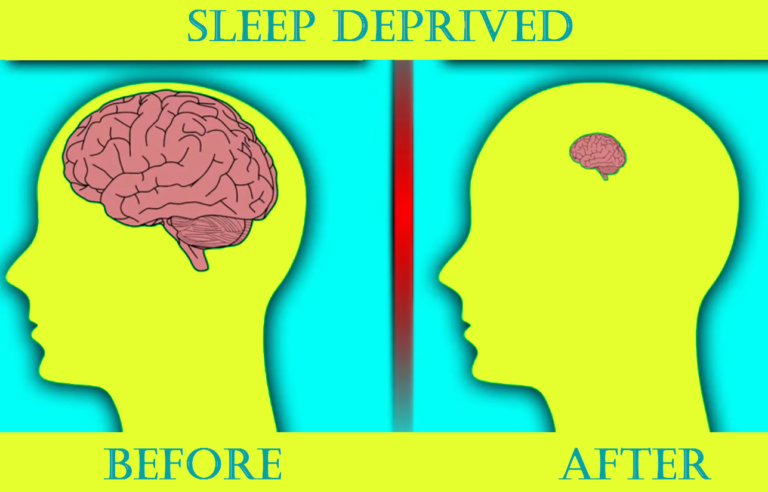How Long You Can Survive Without Sleep? - Sleep Deprivation Death
